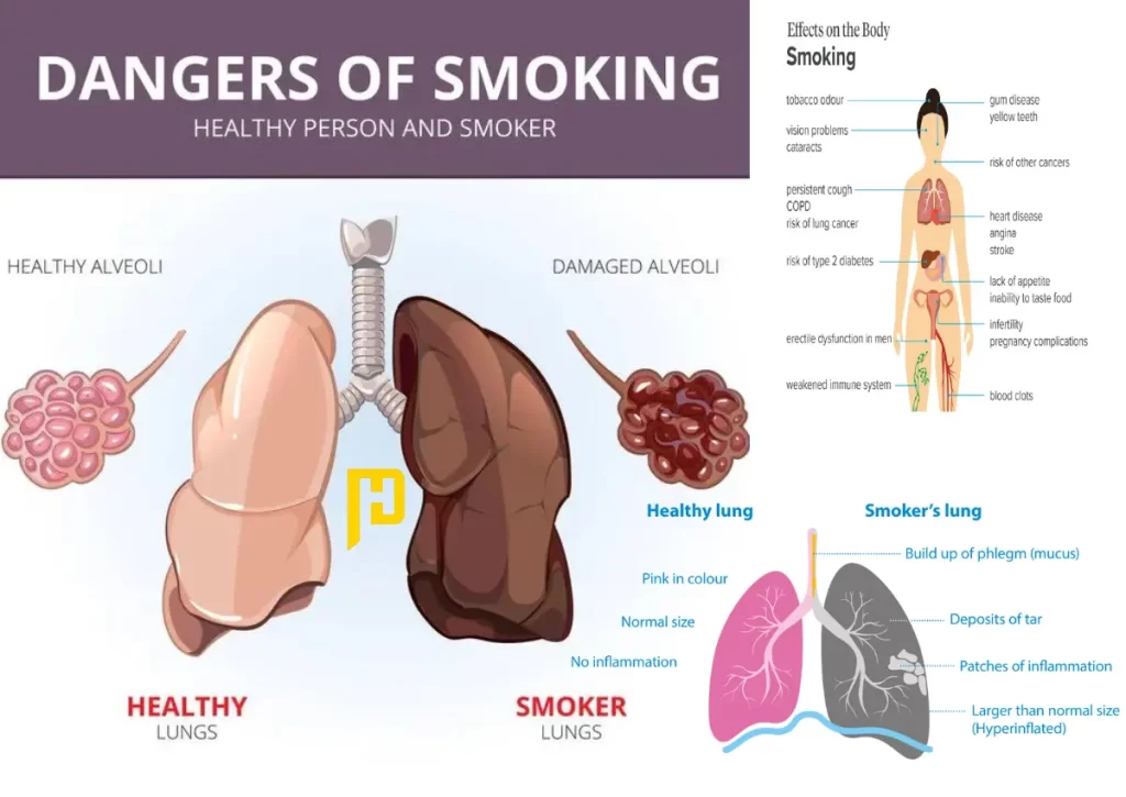 Smoking Damages Lungs And Brain Guideline